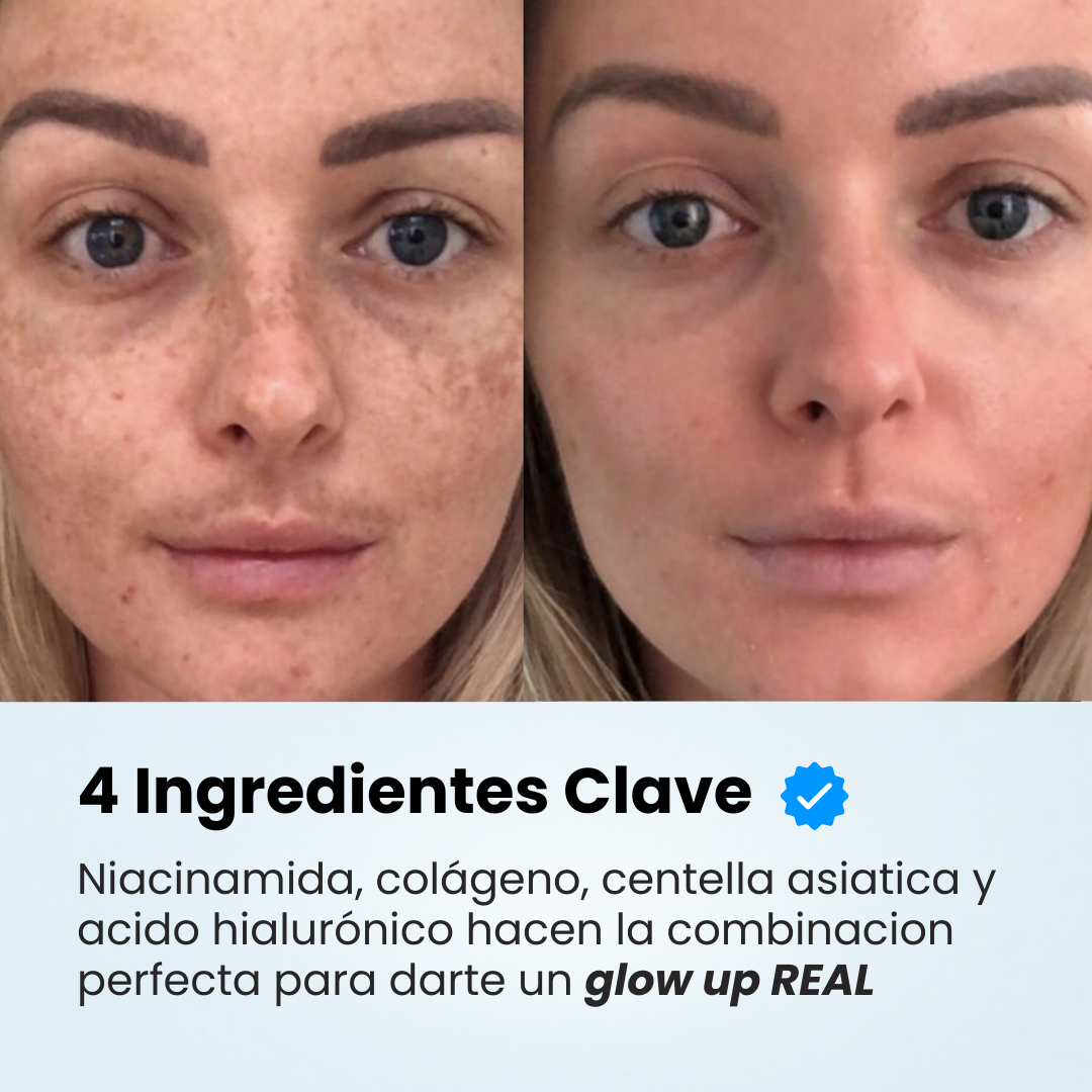 NIDA FaceCream - Coreana Profesional – Mi tienda