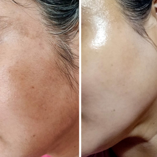 NIDA FaceCream - Coreana Profesional – Mi tienda